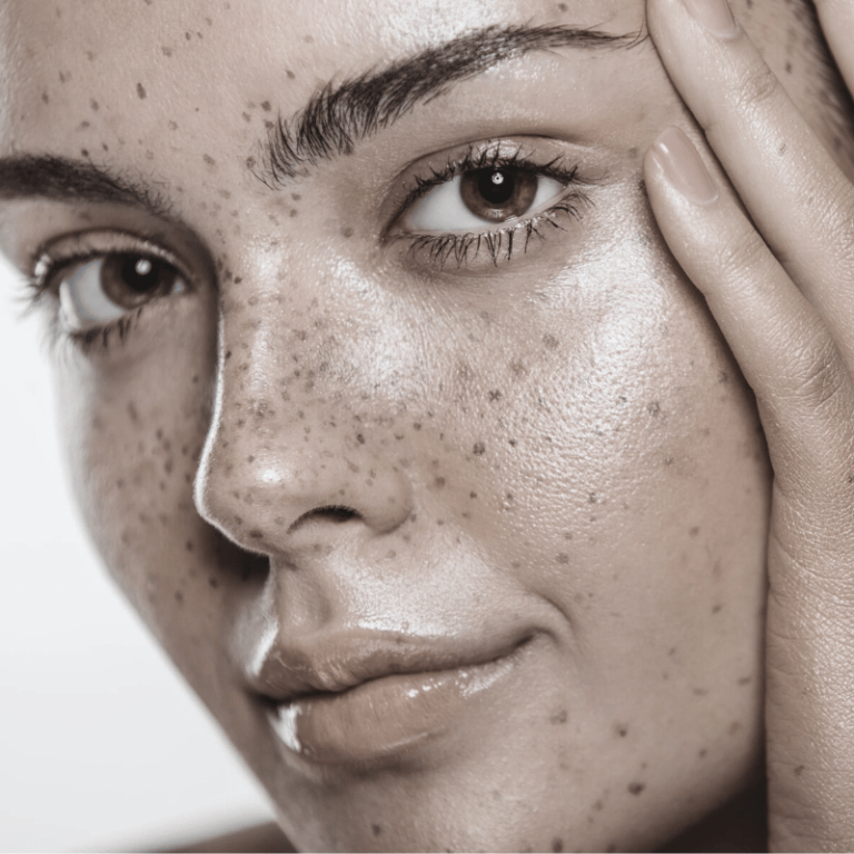 Facial Scar Revision – Face Surgery Doctor – Natasha Berridge ...