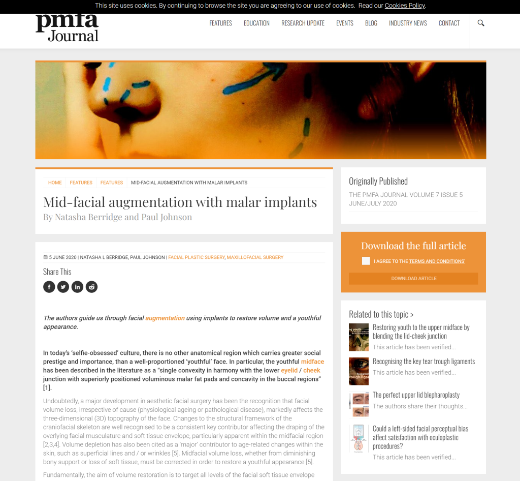 Mid-facial Augmentation with Malar Implants – Face Surgery Doctor ...